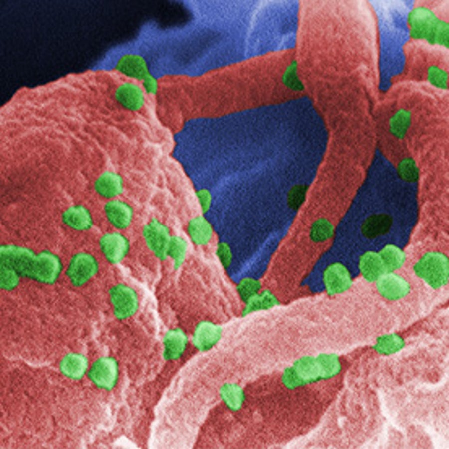 Timeline: A Few Landmarks in the Effort to Treat AIDS | Scientific American