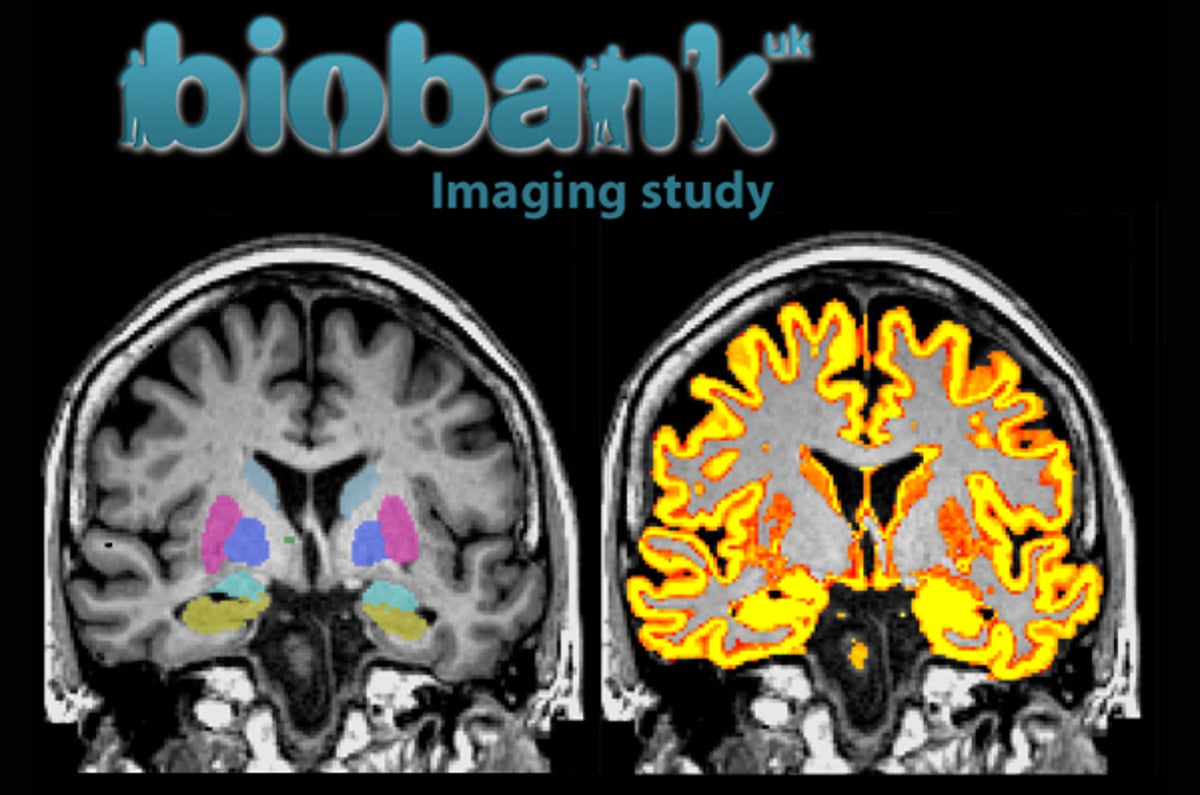 Massive U.K. Brain-Mapping Project Releases First Results | Scientific ...