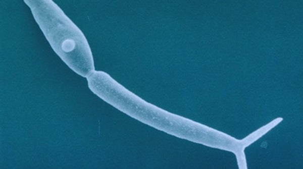 Creepy Swimmer's Itch Parasite in Northern Lakes Can Scratch Summer Fun ...