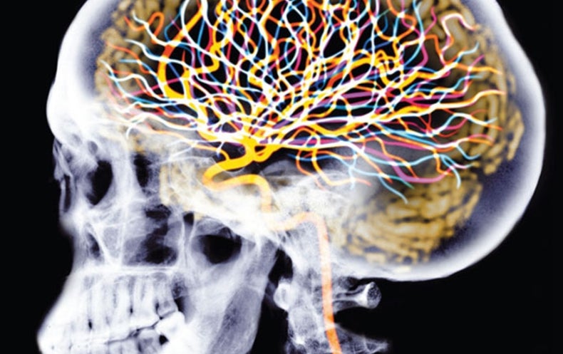 Injectable Brain Implants Talk to Single Neurons - Scientific American