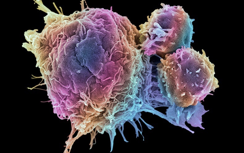 Cancer "Moon Shot" Effort Nets New Funds with NIH–Pharma Partnership ...