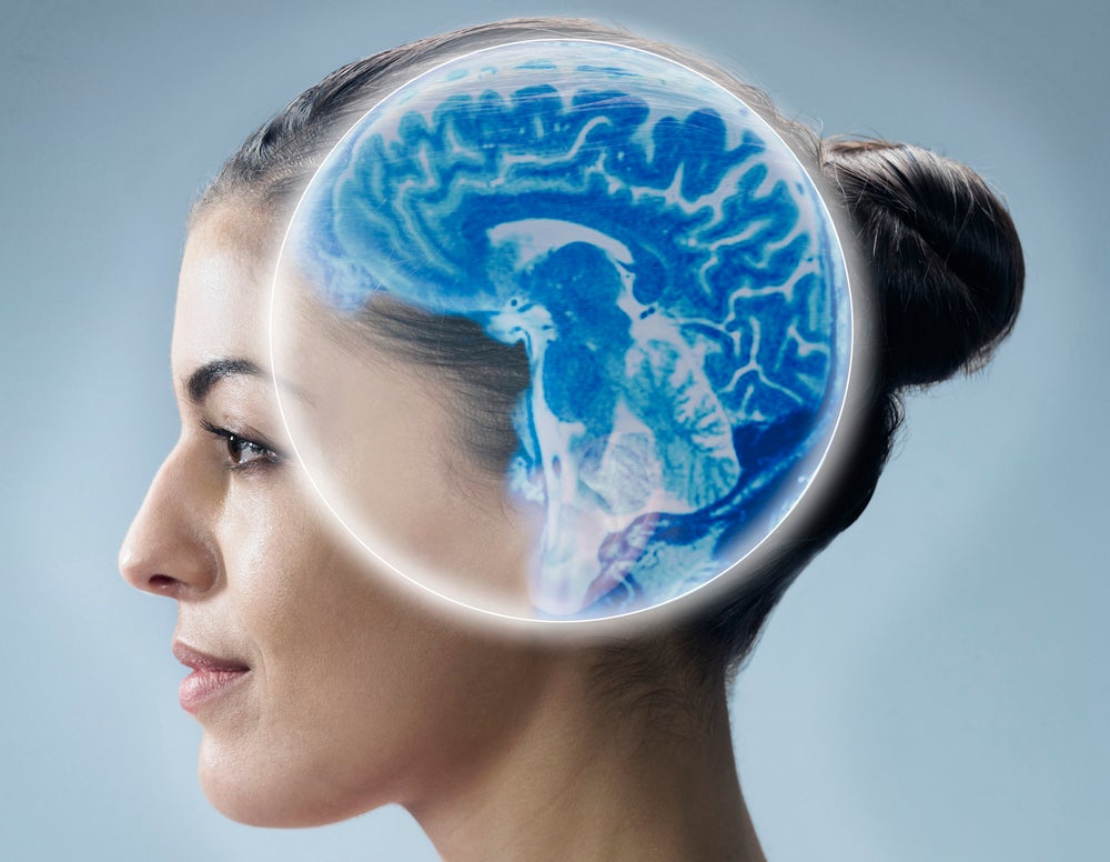 Women's Brains Needed for Concussion Research | Scientific American