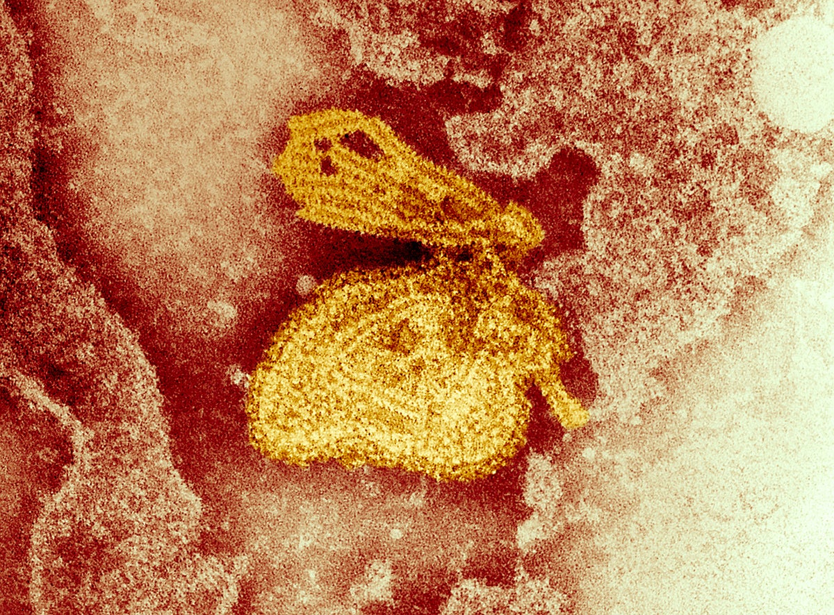 What's behind the 2016 Mumps Spike in the U.S.? | Scientific American