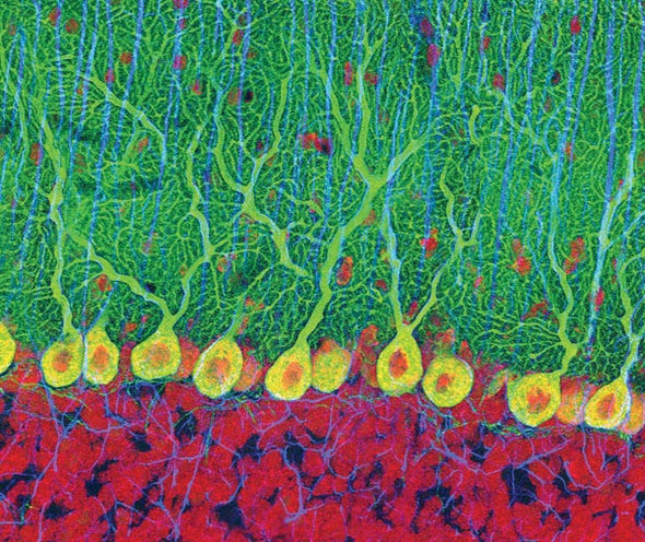 Misfolded Proteins Travel in Huntington’s Disease - Scientific American