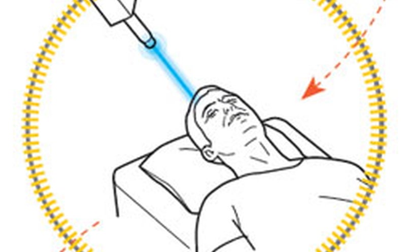 Lasers That Detect Neurological Disease - Scientific American