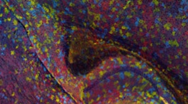 Neural Pointillism: Lighting Up the Brain in Psychedelic Relief [Slide ...