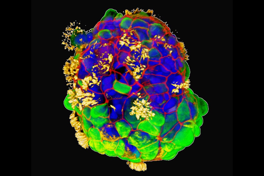 Robots Made from Human Cells Can Move on Their Own and Heal Wounds ...