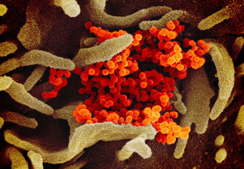 Researchers Map Structure of Coronavirus "Spike" Protein | Scientific ...