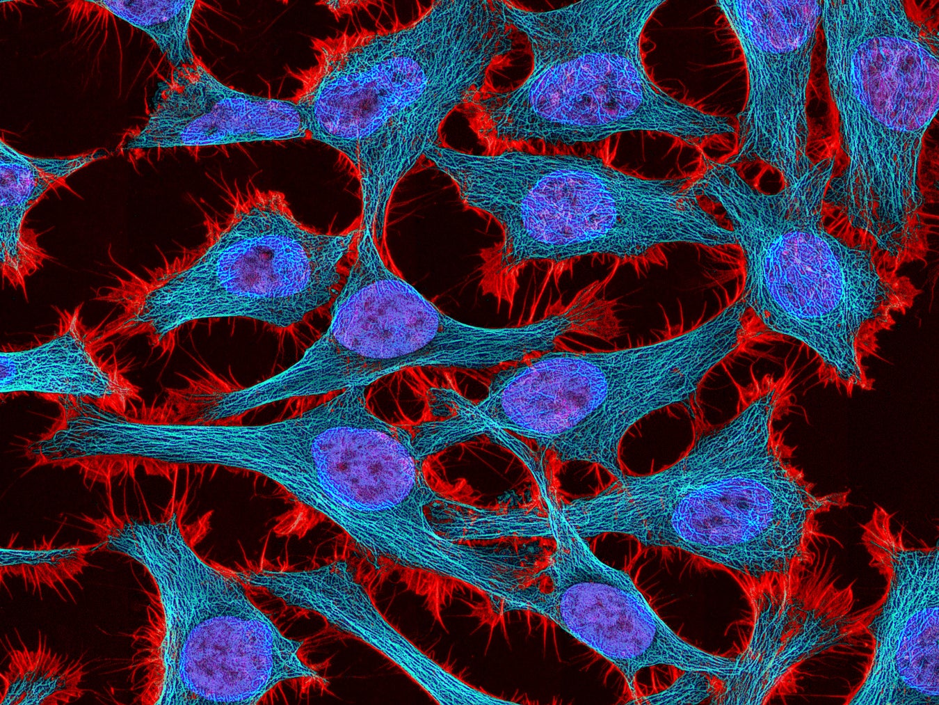 5 Ways Henrietta Lacks Changed Medical Science | Scientific American