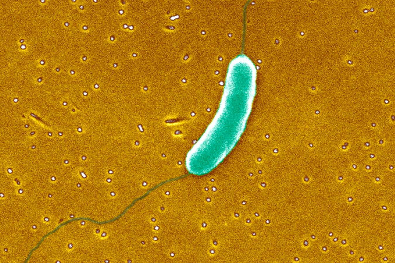 Flesh-Eating Bacteria Infections Are on the Rise in the U.S. Here's How ...