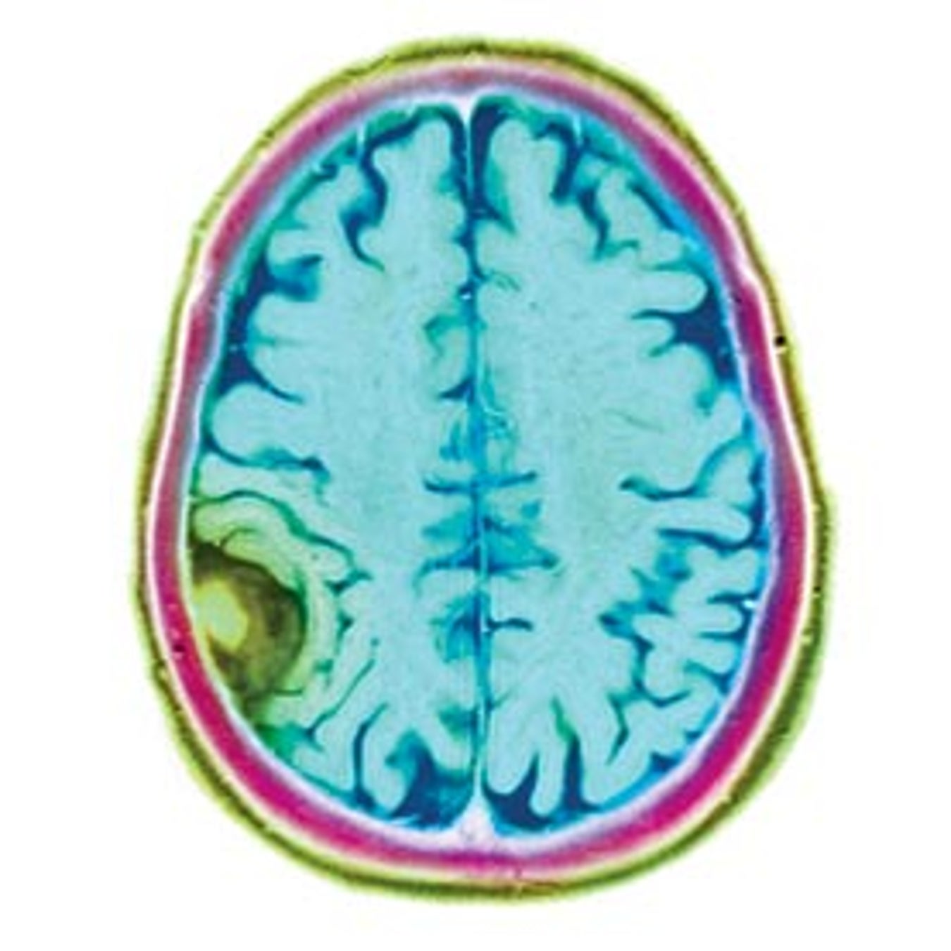 MIND Calendar: November/December 2011 | Scientific American