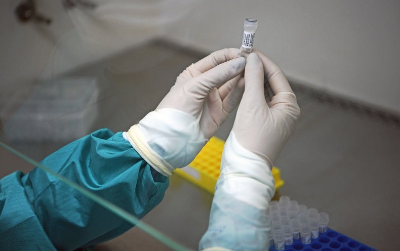 How Does the Coronavirus Test Work? 5 Questions Answered - Scientific ...