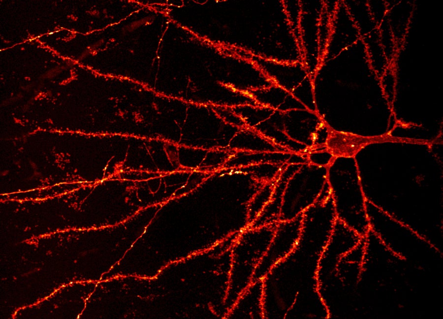 What Makes Human Brain Cells Unique? | Scientific American