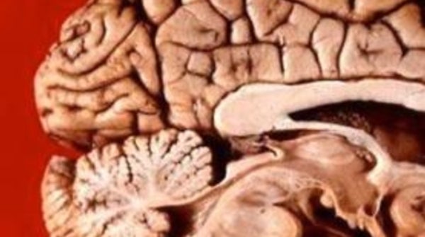 9-Year-Old Boy's Shrinking Brain Disorder Baffles Doctors - Scientific ...