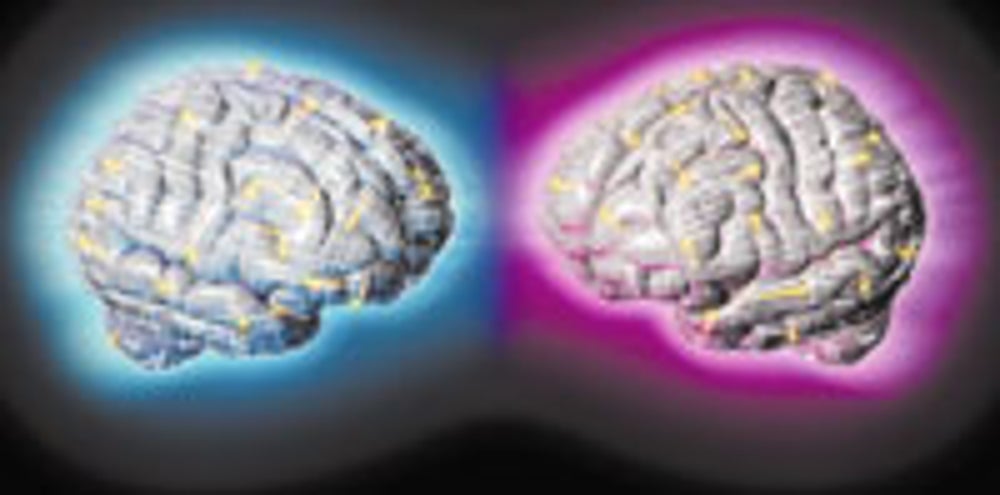 His Brain, Her Brain | Scientific American