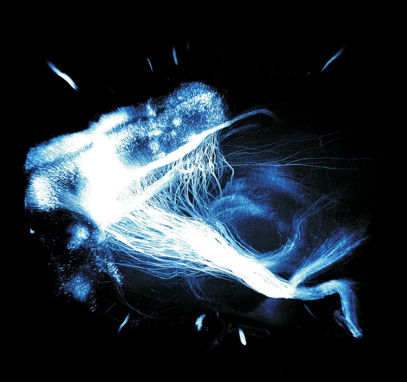 Building a See-Through Brain | Scientific American