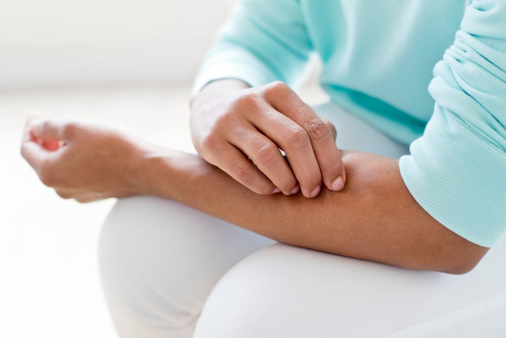 Why Some Pain Relievers Cause Intense Itching | Scientific American
