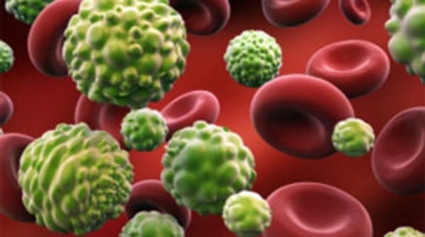 Snap Judgment: Ultrafast Camera Renews Promise of Blood Test for Early ...
