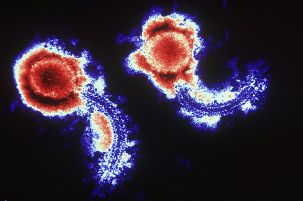 Viruses Can Be Delicious as Well as Deadly | Scientific American