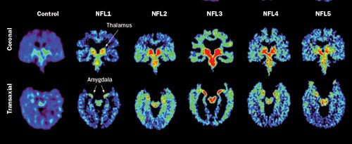 NFL players - Scientific American
