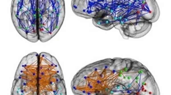 How Men's Brains Are Wired Differently than Women's - Scientific American