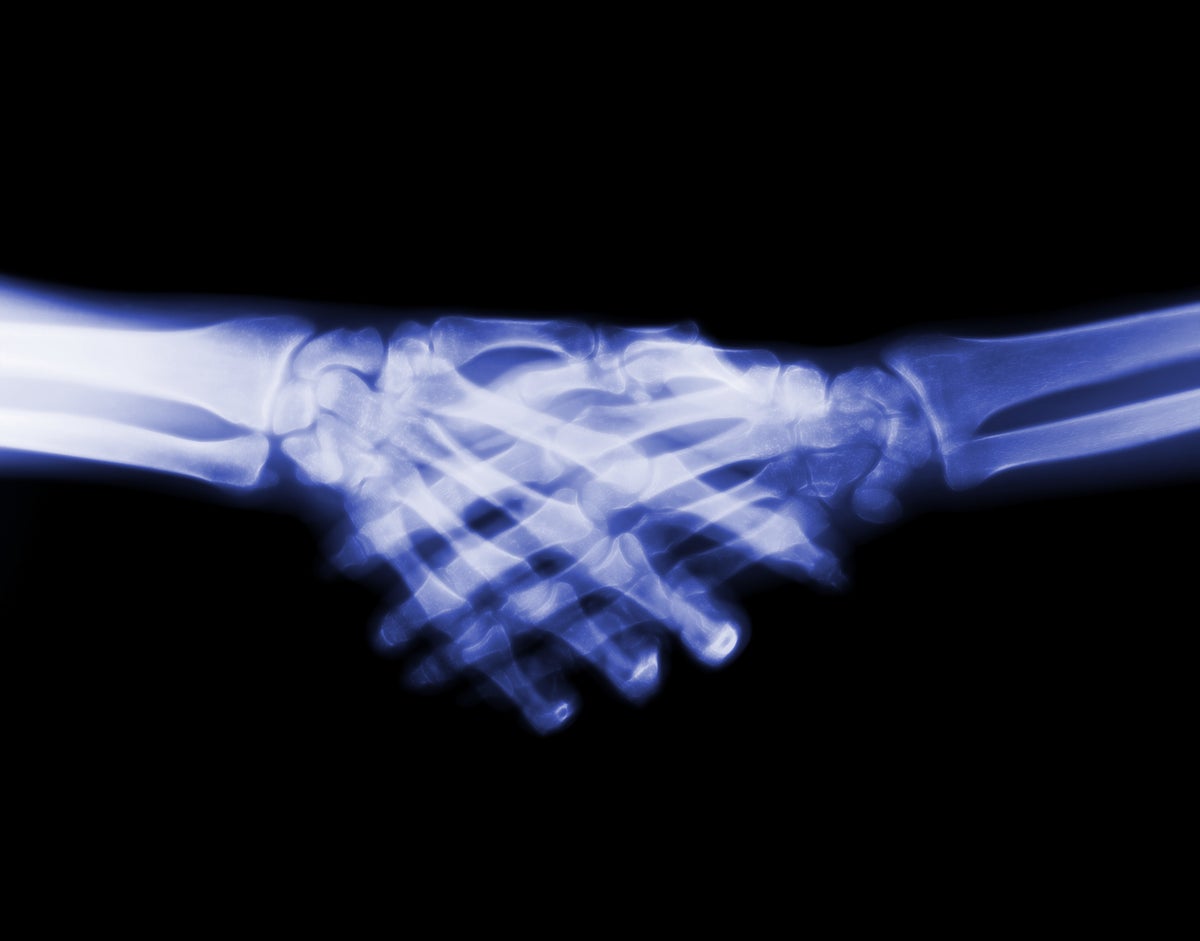 Bone Building Needs Bit of Breakdown First | Scientific American