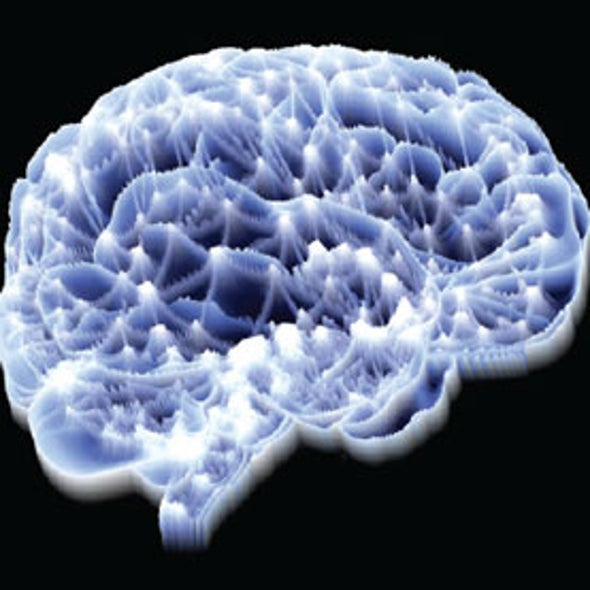 Neuroscientists Identify a Brain Signature of Pain - Scientific American