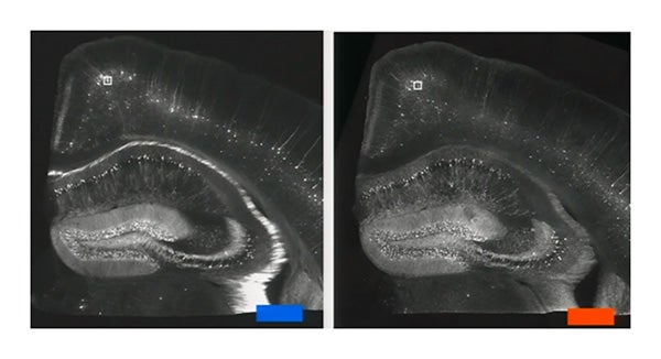Diaper Material Brings Nanoscale Resolution to Ordinary Microscopes ...