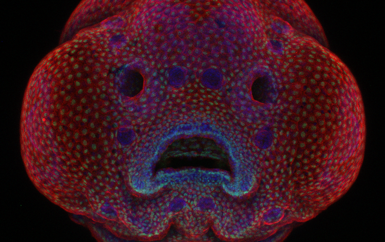 Small Wonders: Science Meets Art Under the Microscope [Slide Show ...