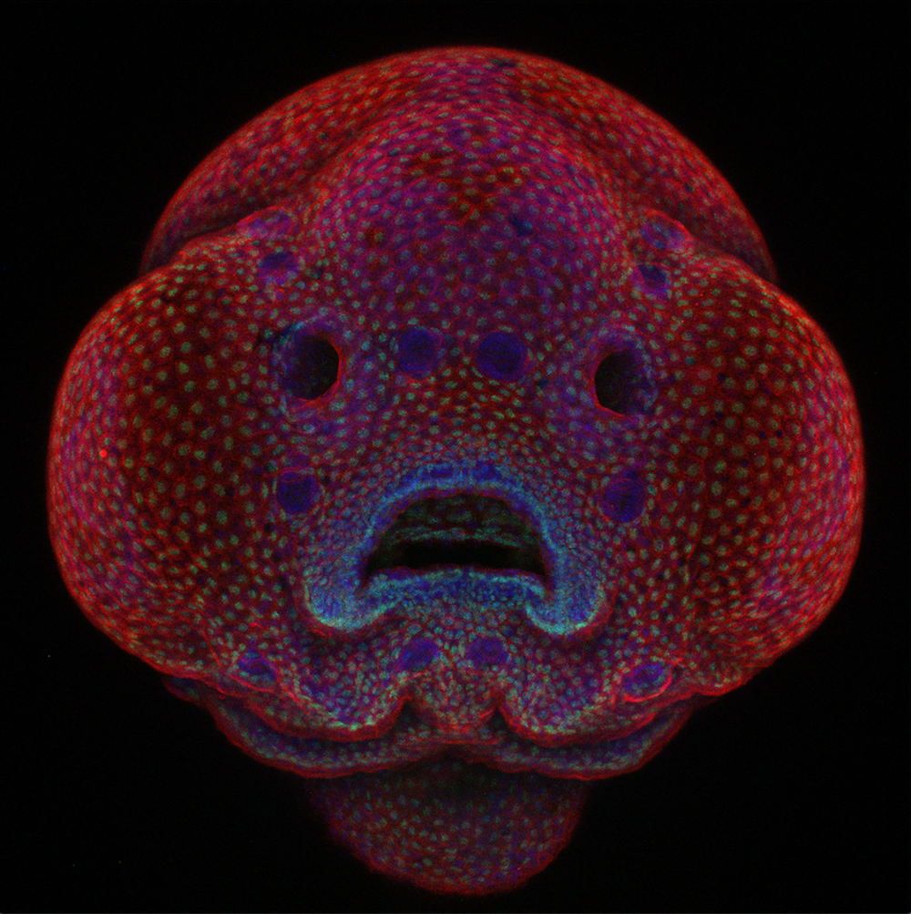 Small Wonders: Science Meets Art Under the Microscope [Slide Show ...