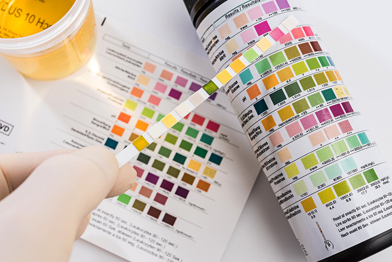 To Treat Overdose Patients Now, Hospitals Must Test for More Kinds of ...