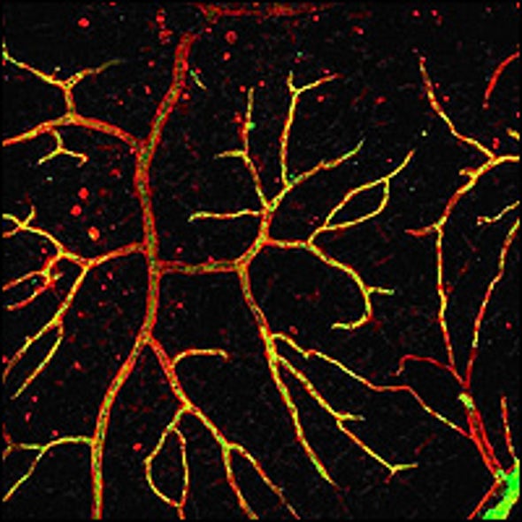 New Recipe for Powerful Stem Cells Promises Greater Insight ...