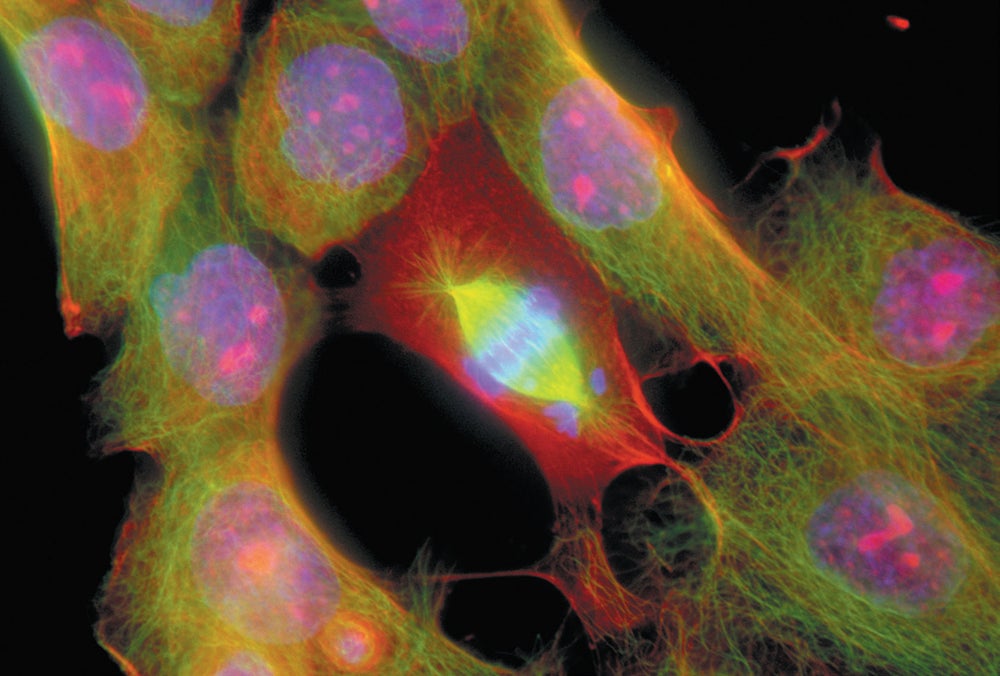 Evolution Research Could Revolutionize Cancer Therapy | Scientific American