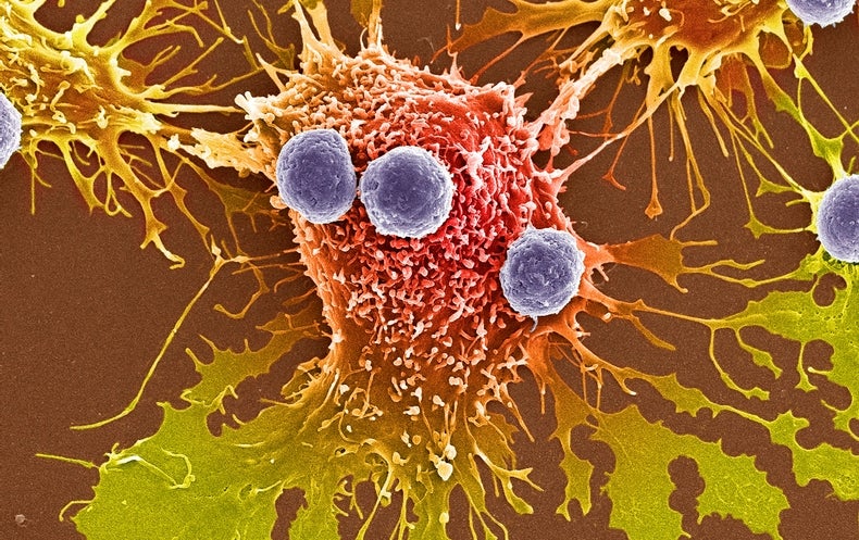 CRISPR Gene-Editing Tested in a Person for the First Time - Scientific ...