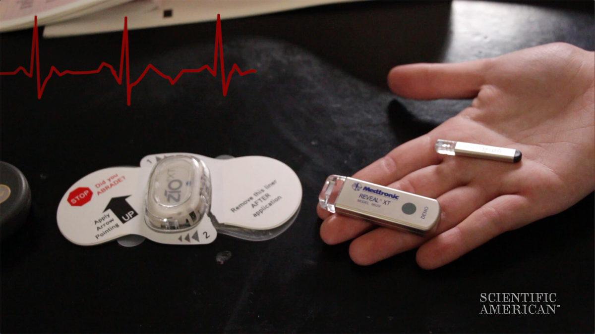 Size Matters--for Heart Monitors | Scientific American