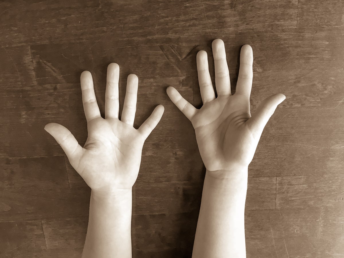 Massive Skin Replacement Saves Child's Life | Scientific American