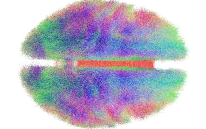 How Do Connectomes Contribute to Human Cognition? - Scientific American