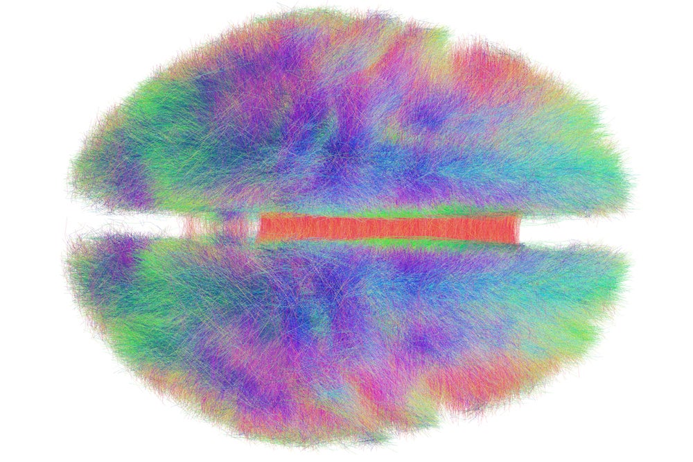 How Do Connectomes Contribute to Human Cognition? | Scientific American