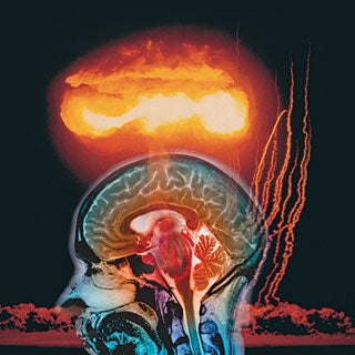Impact and the Brain - Scientific American