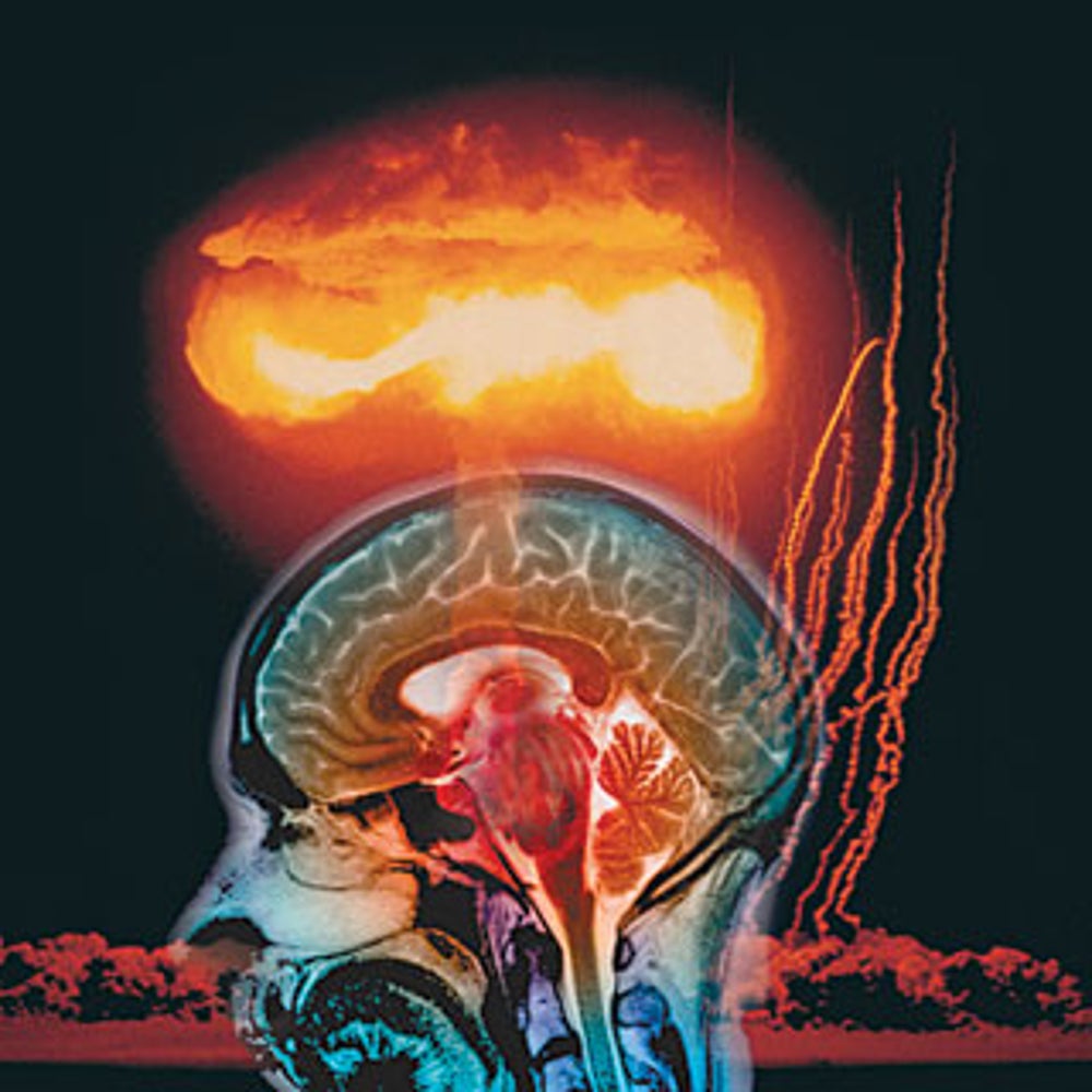 Impact and the Brain | Scientific American