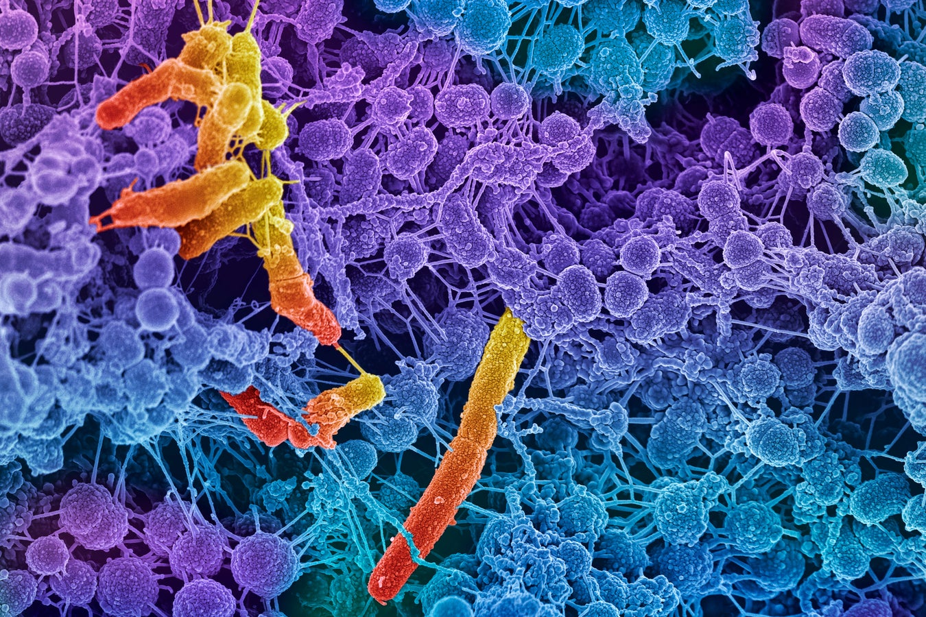 Weird 'Obelisks' Found in Human Gut May be Virus-Like Entities ...