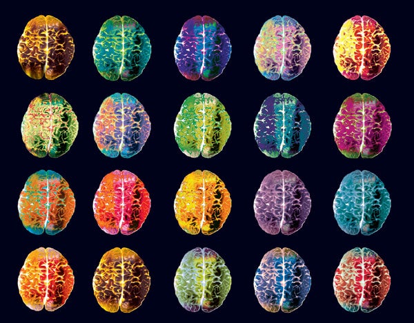 What Does a Smart Brain Look Like? - Scientific American