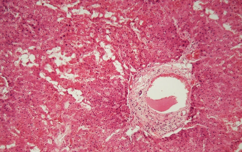 Innovations to Detect Cancer at Its Origin - Scientific American