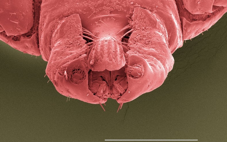 First Local Case of Tick-Borne Disease Kills Man in Spain - Scientific ...