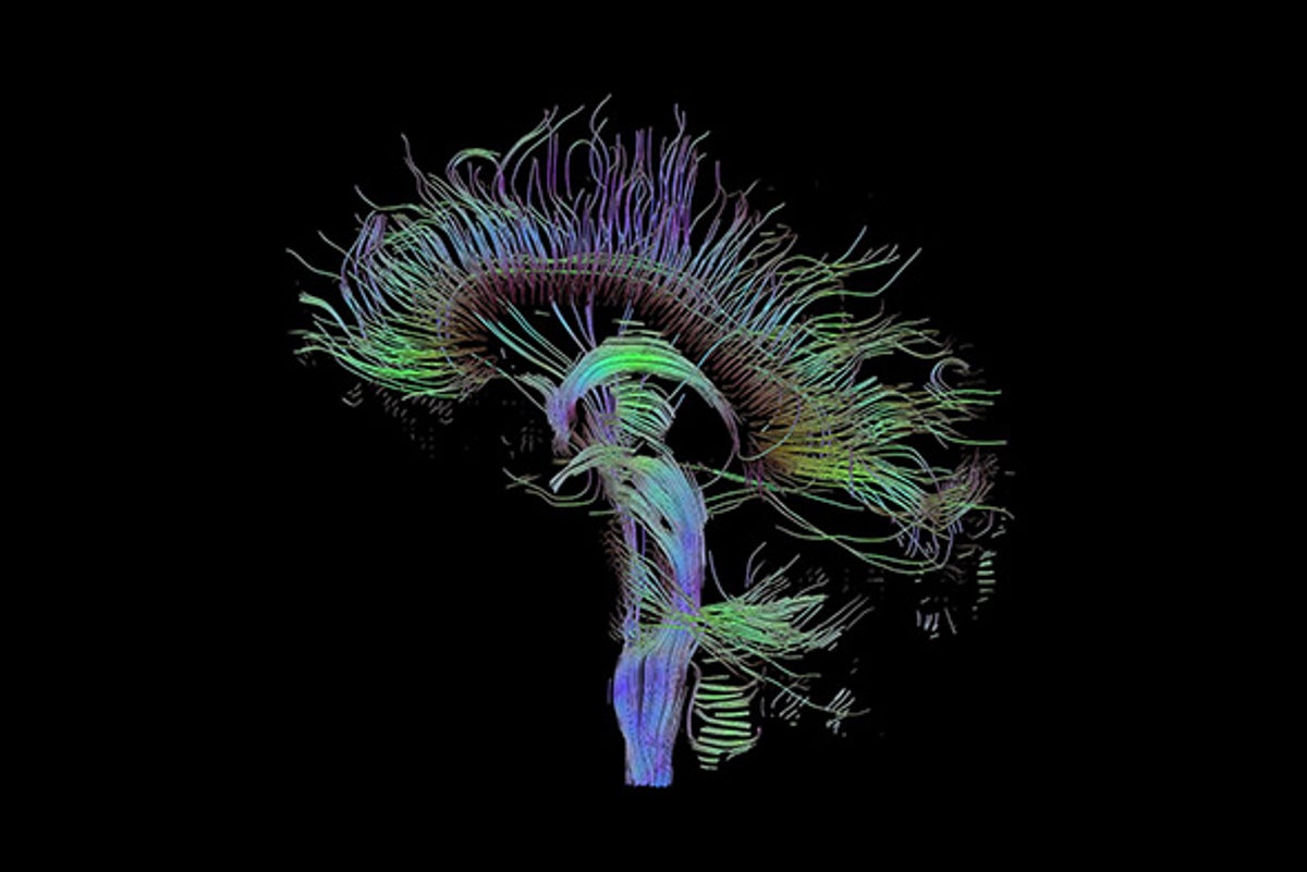 Neuroscience: Big Brain, Big Data | Scientific American