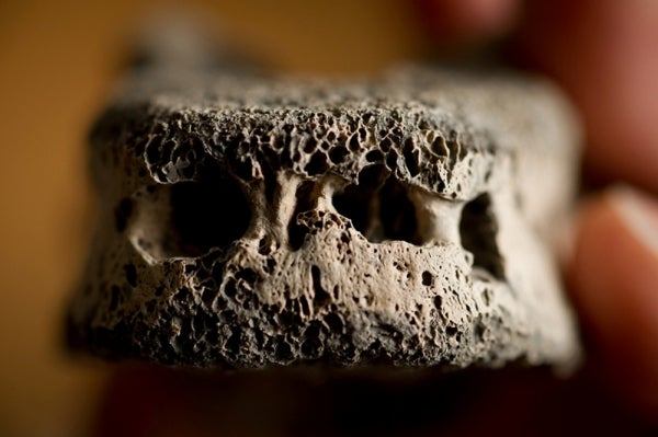 Lives in Ruins: A New Diagnosis for Diseased Ancient Bones - Scientific ...