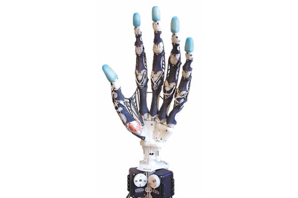 Tomorrow's Prosthetic Hand - Scientific American