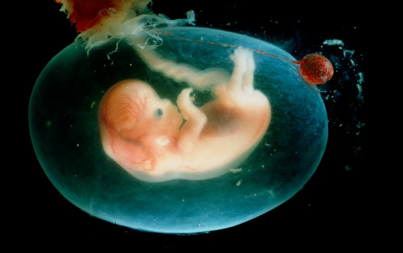 Scientists Call For Do Over For Rules On Creating Crispr Babies