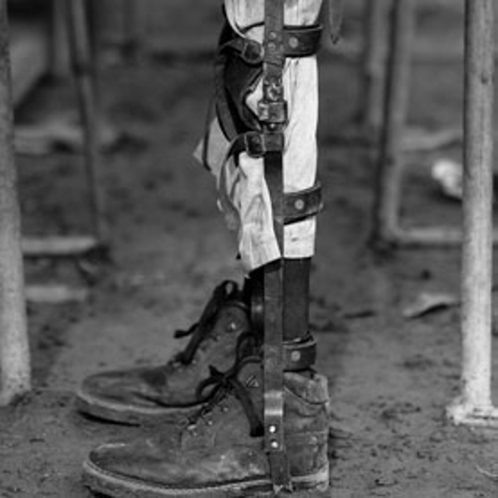 Why Polio Isn't Going Away | Scientific American