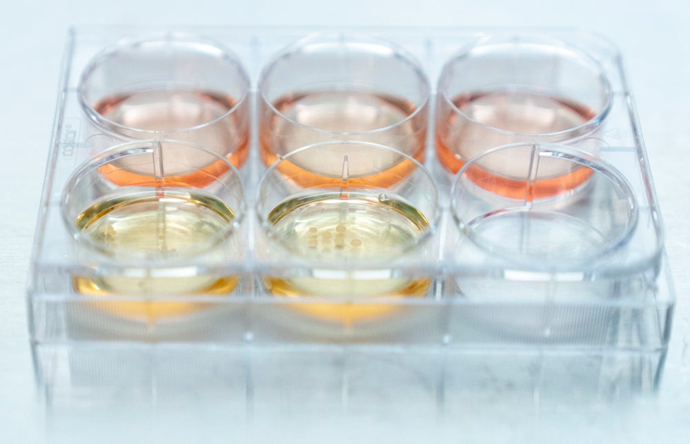 Lab-Grown "Mini Brains" Can Now Mimic the Neural Activity of a Preterm ...